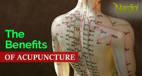 The Benefits Of Acupuncture Dr Pat Nardini Naturopathic Doctor