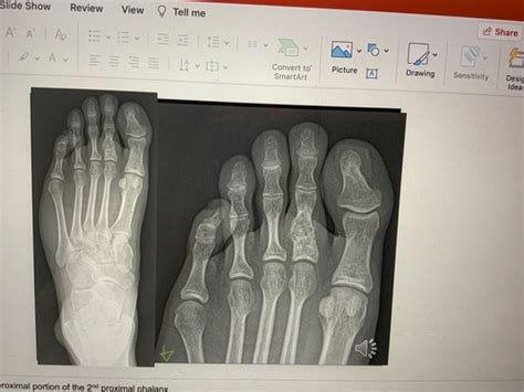 Week 1 Lab Flashcards Quizlet