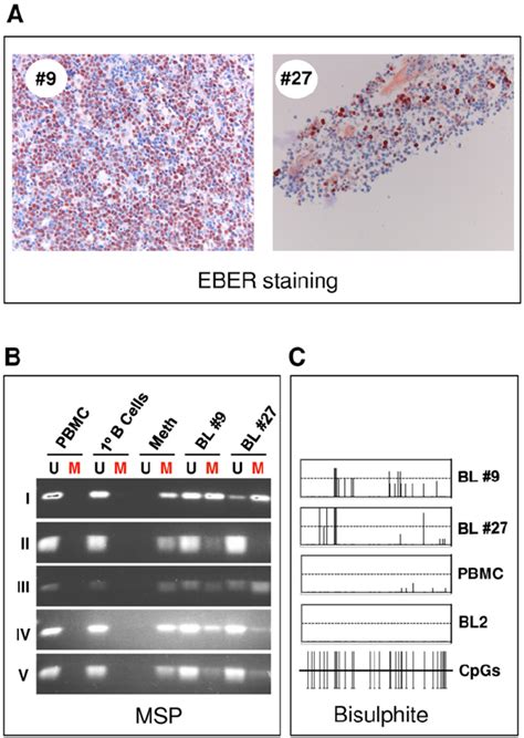 Dna Methylation Analysis Of The Bim Promoter By Msp And Bisulphite