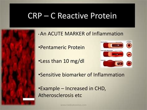 Crp C Reactive Protein Origin Name And Overview Pptx