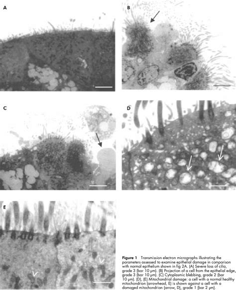 Figure From AIRWAY BIOLOGY Functional Analysis Of Cilia And Ciliated Epithelial Ultrastructure