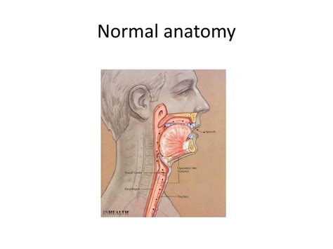 Laryngectomy Anatomy