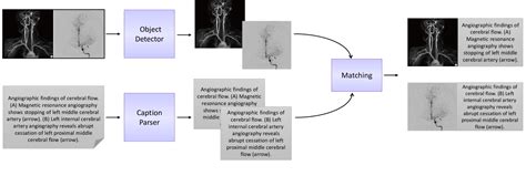 Medical Vision Language Pre Training For Brain Abnormalities AI