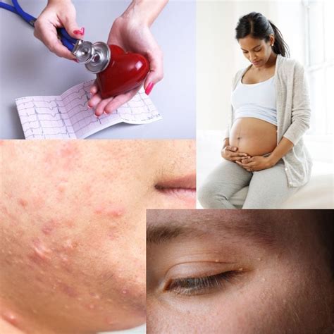 Pros Y Contras De La Radiofrecuencia Facial