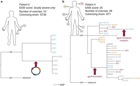 The Microevolution And Epidemiology Of Staphylococcus Aureus Colonization During Atopic Eczema