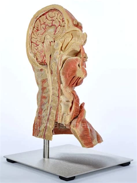 Trigeminal Nerve Cavernous Sinus And Orbit