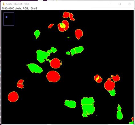 counting pixels by color within discrete blobs image analysis image