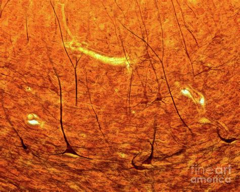 Pyramidal Cells In Cerebral Cortex 1 By Jose Calvo Science Photo Library