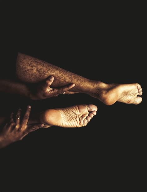 What Is A Heel Fat Pad Syndrome