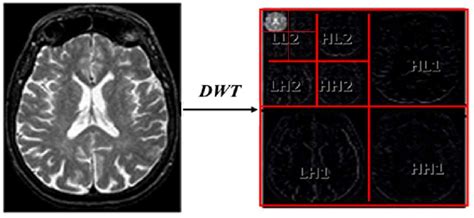 Dwt 3 Level For Brain Mri Download Scientific Diagram