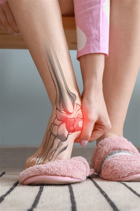 Gout In Your Heel Causes And Treatment Options Bilt Labs