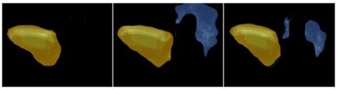 movement in a video detection scheme for sign language gesture