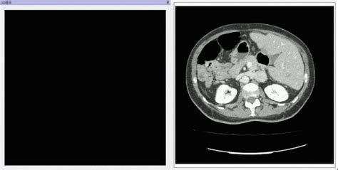 Readmemd · Github 加速计划 Pa Paddleseg Gitcode