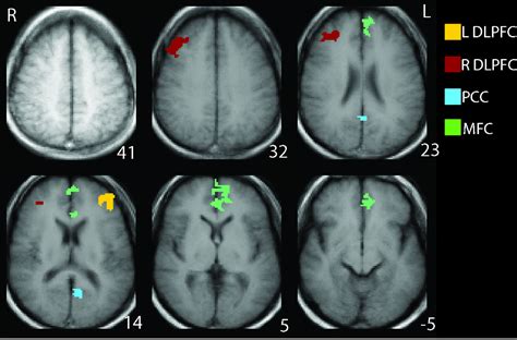 Figure 1 From Functional Connectivity Between Task Positive And Task Negative Brain Areas And