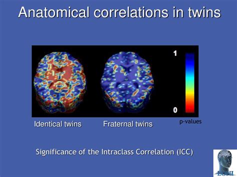 Ppt Generalized Tensor Based Morphometry Tbm For The Analysis Of