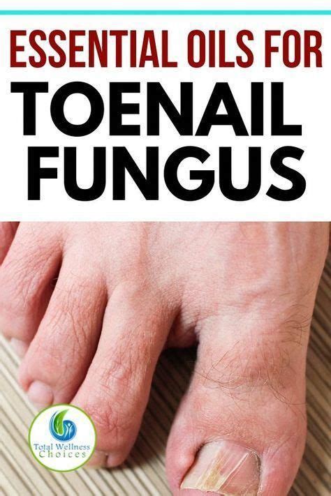Essential Oils For Fungal Infections Treat Skin Nails Feet And More