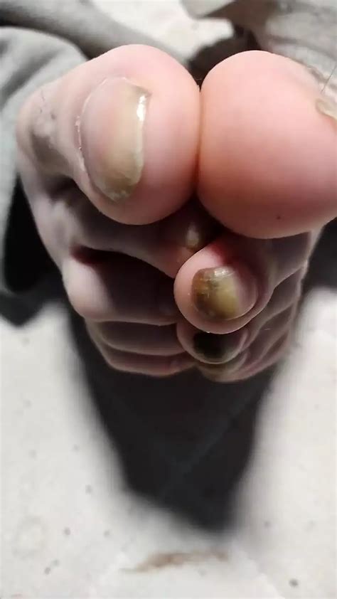 Unleashing The Beauty Of My Naked Feet For You Gay Porn 99 XHamster