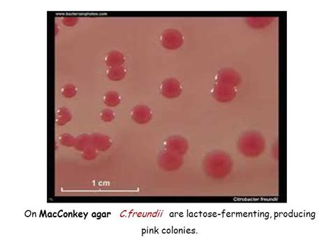 The Importance Of The Citrobacter Freundii Urease Test For Accurate