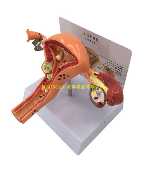 Simulation Of Female Models Of Common Human Uterine And Ovarian
