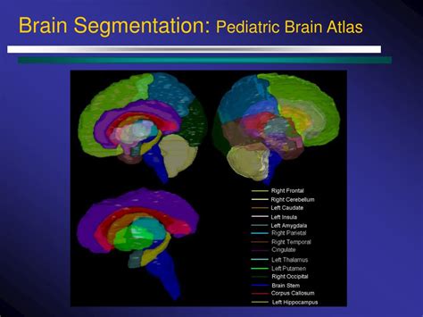 Ppt Quantitative Brain Structure Analysis On Mr Images Powerpoint