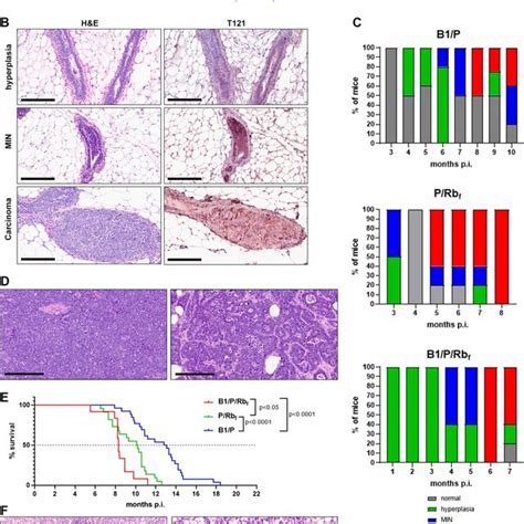 Development And Characterization Of Mammary Cancer Models A Oncoprint