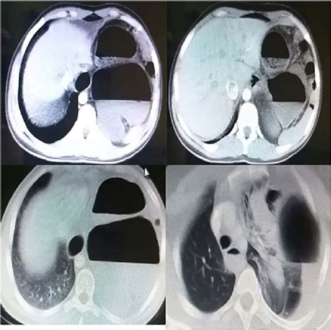 Presurgical Ct Scan Download Scientific Diagram