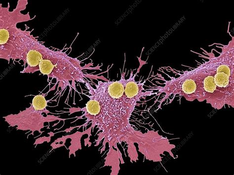 Car T Cell Therapy Sem Stock Image C0474870 Science Photo Library