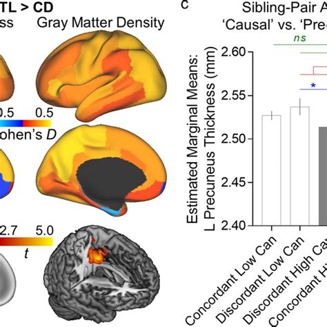 Group Differences In White Matter Microstructure Two Sample T Test