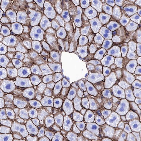 β Catenin Recombinant Rabbit Mab Sdt 336 23p35222斯达特公司官网