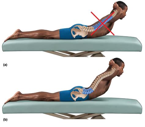 Osteoarthritis Spine Exercises Microendoscopic Laminectomy Surgical
