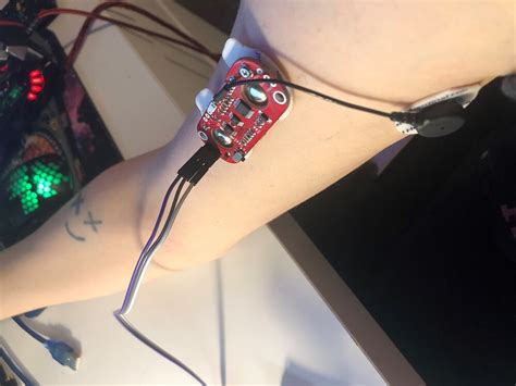 Myoware Muscle Sensor Not Working Help Sensors Arduino Forum