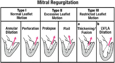 Carpentier Classification Of Mitral Regurgitation Mr 11 Download Scientific Diagram