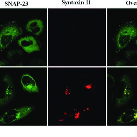 Snap 23 Colocalizes With Syntaxin 11 On Intracellular Membranes Hela