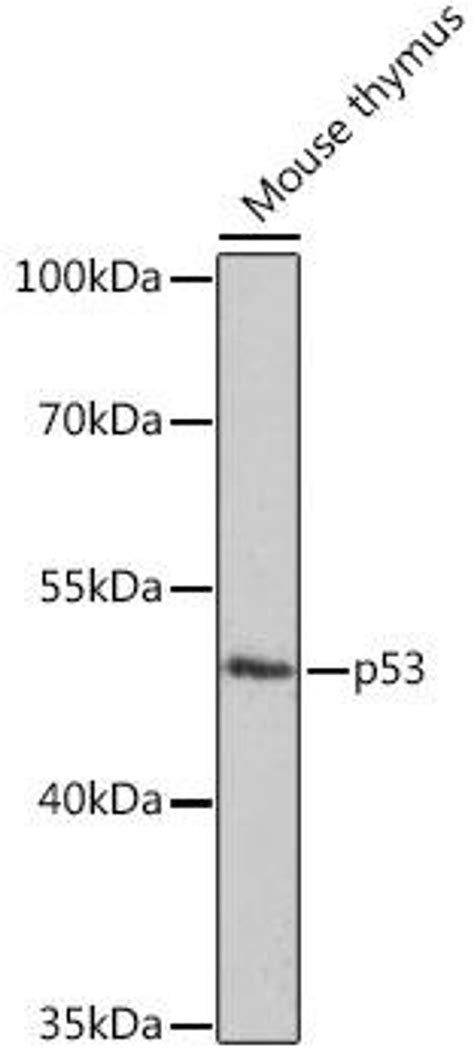 Elisa Kits Assays And Antibodies Assay Genie