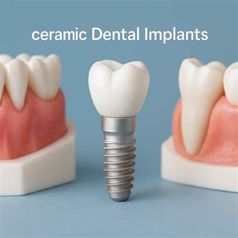 Ceramic Dental Implants A Complete Guide Redent Clinic Oral And