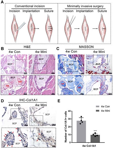 Minimally Invasive Implantation And Decreased Inflammation Reduce Osteoinduction Of Biomaterial