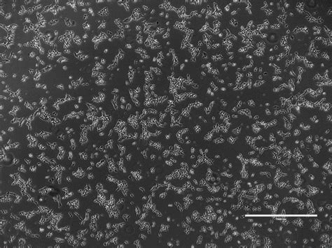 Confluency Tool Cell And Gene Therapy Cell And Gene Therapy Catapult