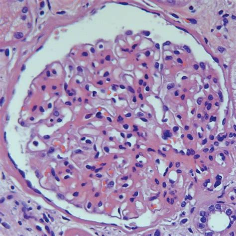 Gill S Hematoxylin 3 Triple Strength For Histology Polysciences Inc