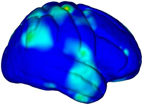 2 Correlation Maps Between Specic Reference Points And Other Brain