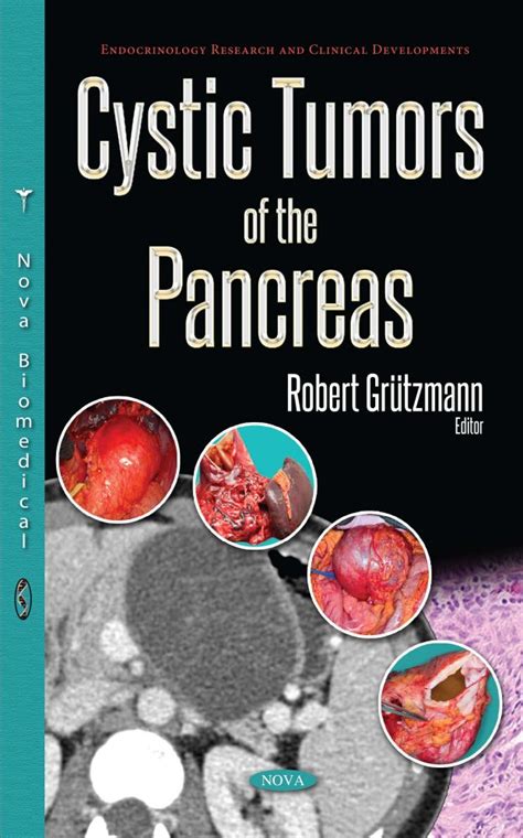 Cystic Tumors Of The Pancreas Nova Science Publishers