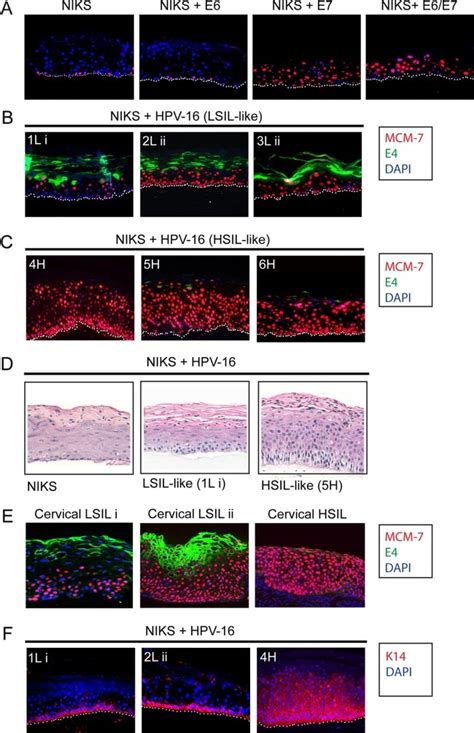 Hpv Type 16 E7 Antibody Monoclonal 8c9