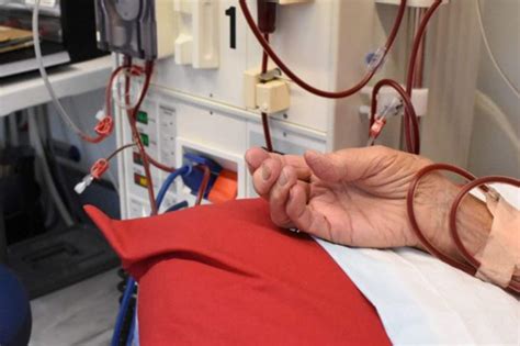 House OKs Bill Providing Free Dialysis Treatment To Indigent Patients