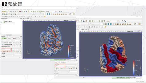 Adni数据库t1mri数据处理——基于freesurfer与matlab（2）vtk文件用什么软件打开 Csdn博客