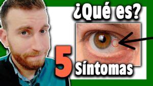 Bulto En El Ojo En La Parte Blanca Completo DrLinares