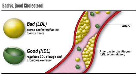 Ldl Vs Hdl Venn Diagram Structure Hdl Ldl Cell Differences B