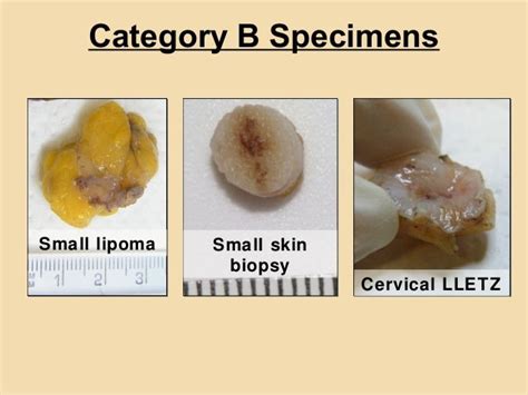 Histopathology In Practice Sample Reception Dissection Processing…