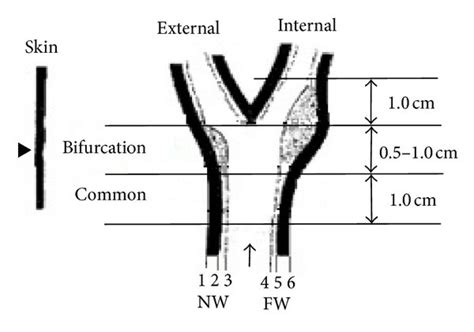 The Carotid Artery View With The Interfaces 1 Download Scientific Diagram