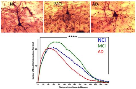 Hippocampal Plasticity During The Progression Of Alzheimer S Disease Abstract Europe PMC