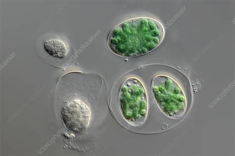 Glaucocystis Sp Algae Light Micrograph Stock Image C057 7477 Science Photo Library