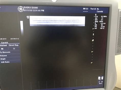 Ge Logiq 9 Bt07 4502 Everx Used Medical Imaging Equipment Ct